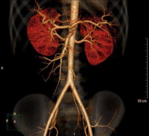 CT-Scan – Kippax Medical Imaging